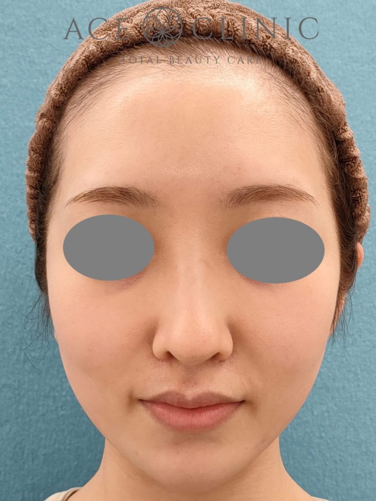 症例紹介 | 【エースクリニック】名古屋院